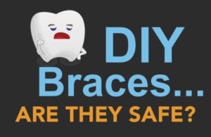 The Dangers of DIY Orthodontic Braces