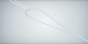 Flossing with Braces: Tools, Tips, and Step-by-Step Guide