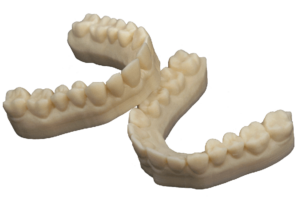 Retainer Replacement: How Often, Cost, and How to Get One