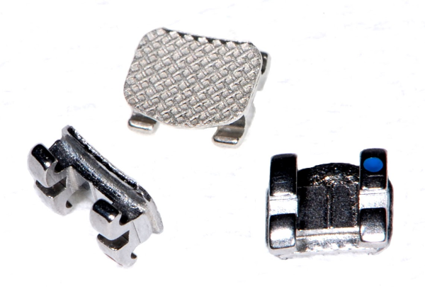 How Do Braces Work? - Premier Orthodontics