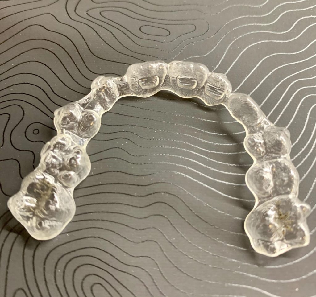 Can Invisalign® Fix Deep Bites? Before & After Real Results
