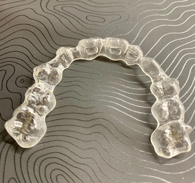 Can Invisalign® Fix Deep Bites? Before & After Real Results